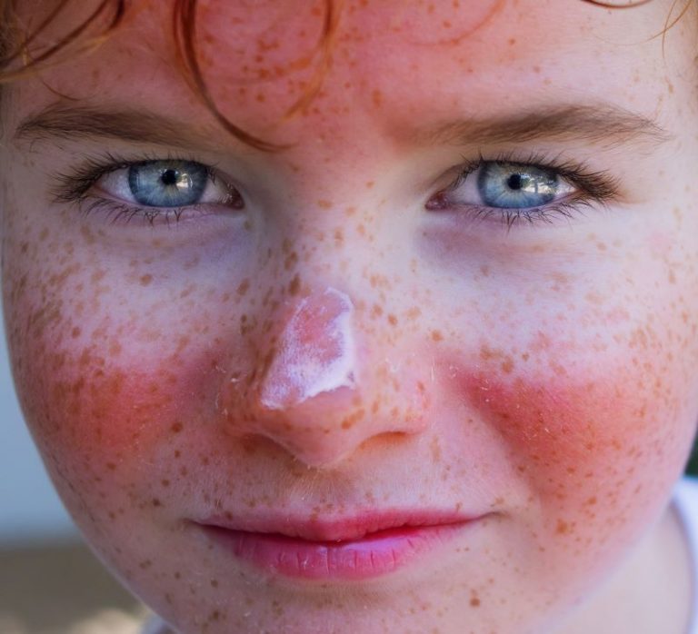 Seven Ways to NOT Get a Sunburn - Family Fun Canada